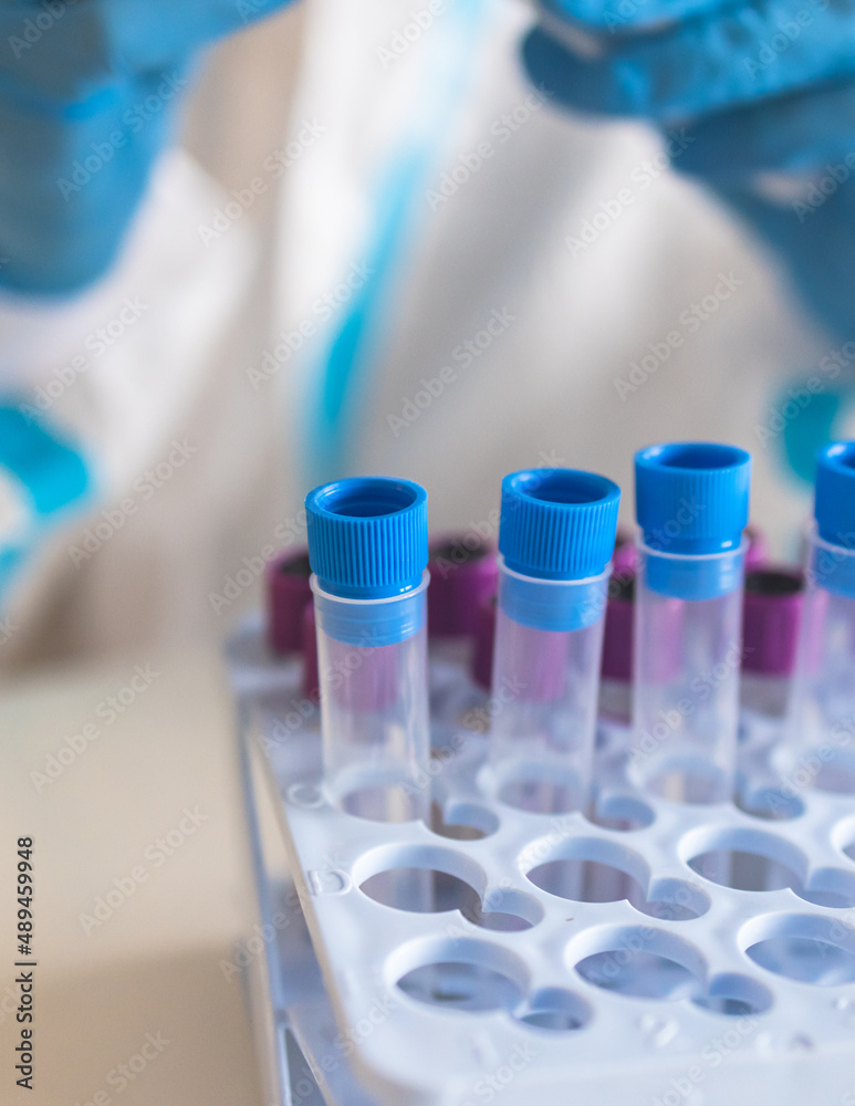 Process of coronavirus PCR antigen testing examination by nurse medic ...