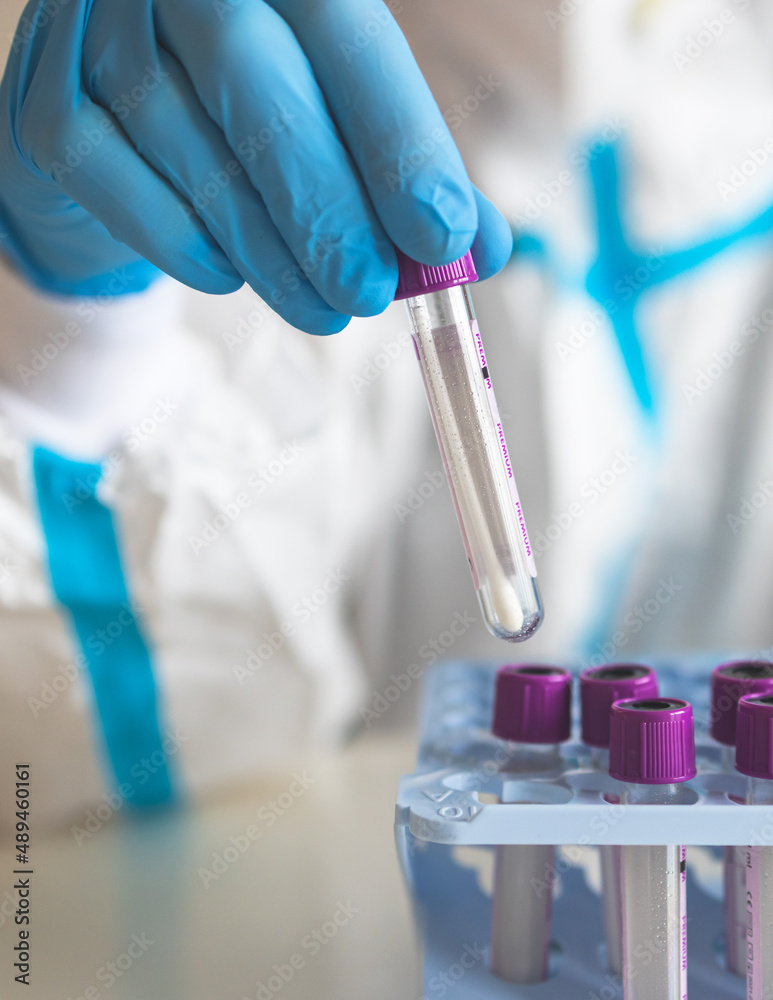 Process of coronavirus PCR antigen testing examination by nurse medic ...