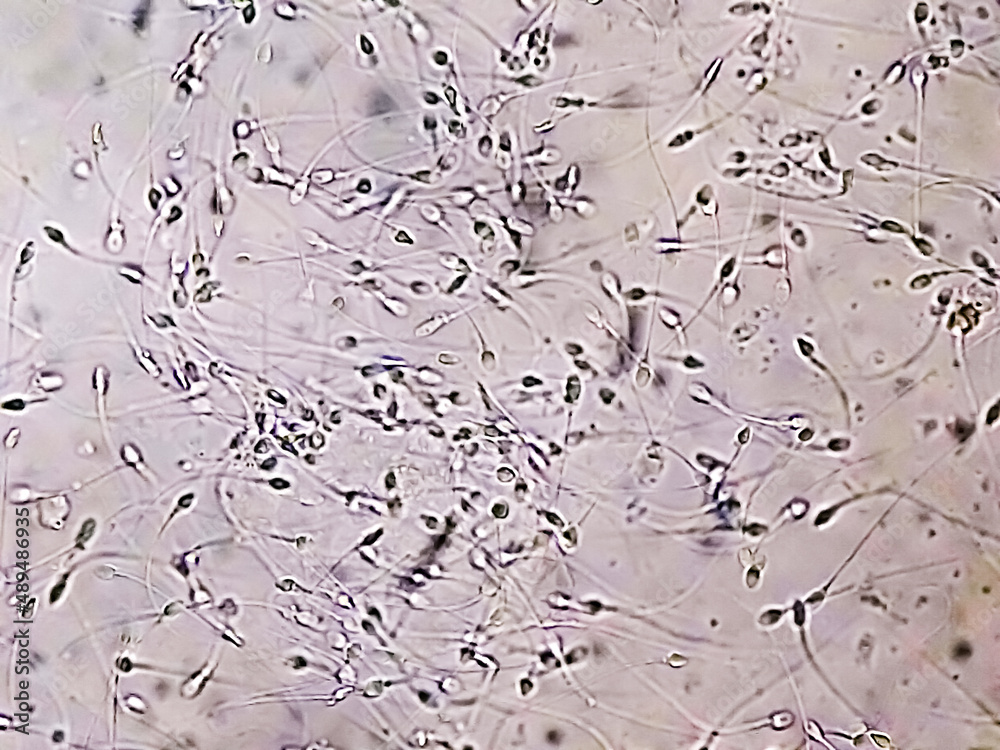 Sperm Microscope Sperm Microscope