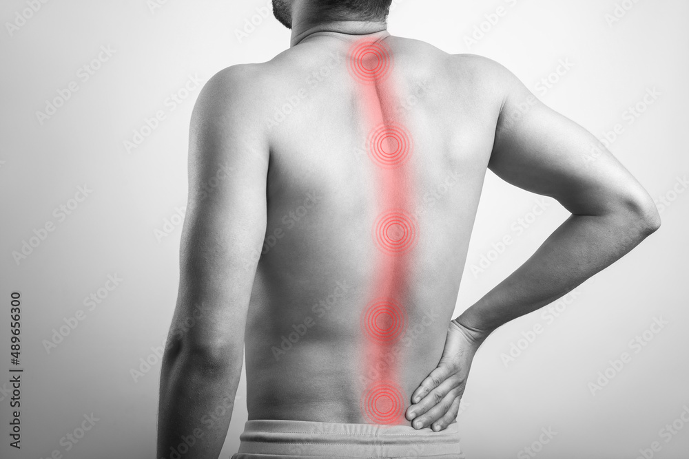 shirtless monochrome man with spinal cord injury pain Stock Photo ...