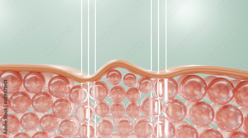 laser or serum vitamin through the skin layer for repair wrinkles and ...