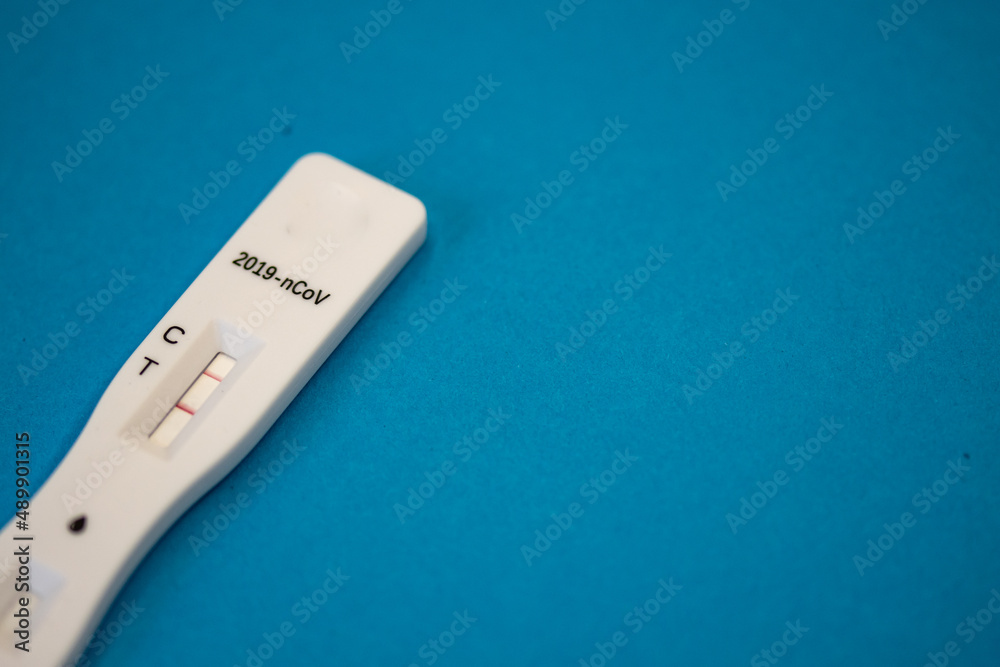 Covid positive test detail. Positive result of the SARS-Cov-2 ...