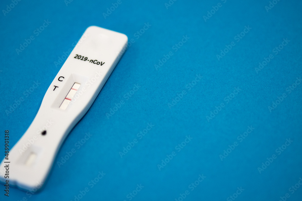 Covid positive test detail. Positive result of the SARS-Cov-2 ...