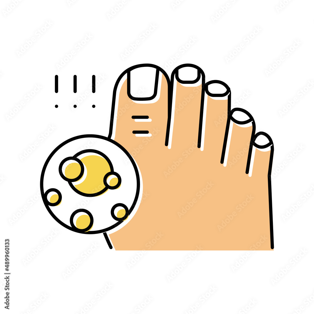 uric acid crystals gout color icon vector illustration Stock Vector ...