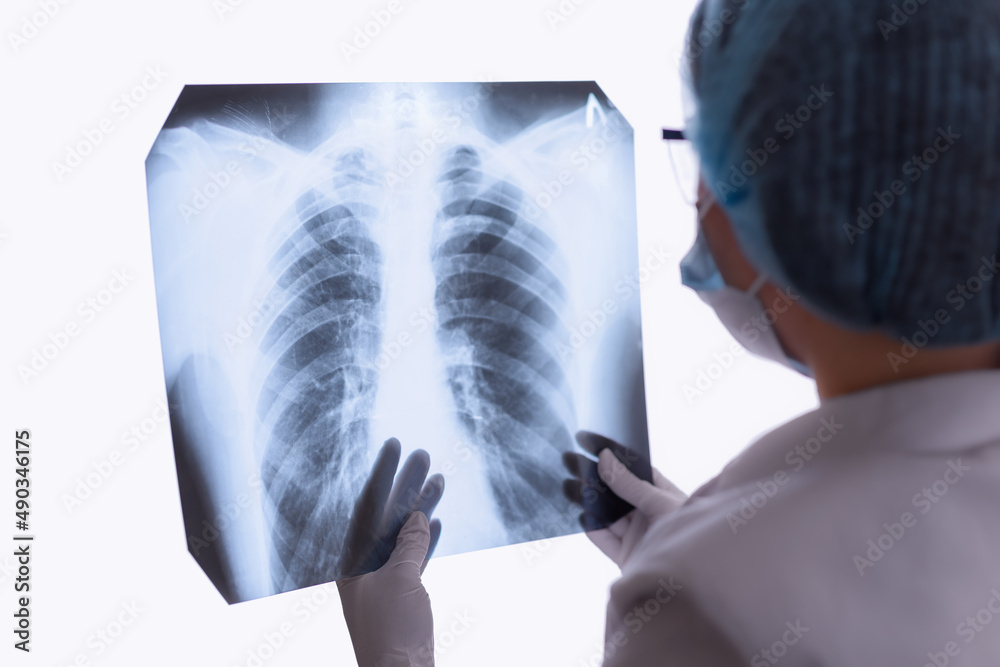 Doctor or radiologist examines a chest x-ray of a patient in a hospital ...