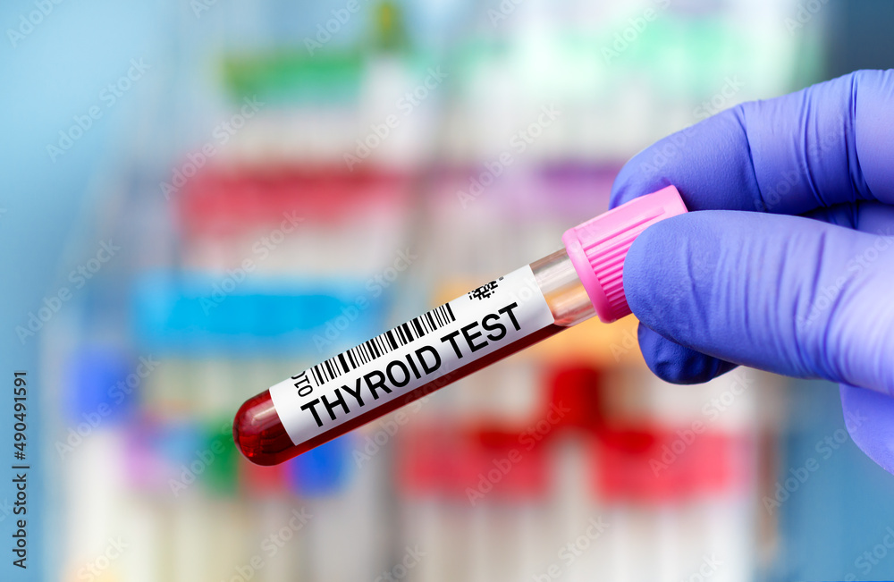 Blood tube test for Thyroid test. Blood sample tube for analysis of ... Blood tube test for Thyroid test. Blood sample tube for analysis of ...
