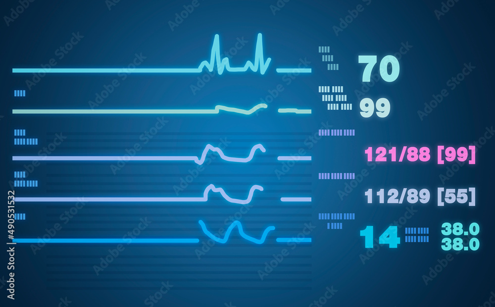 Poster Patient monitor showing vital signs ECG and EKG – Wall Art ...