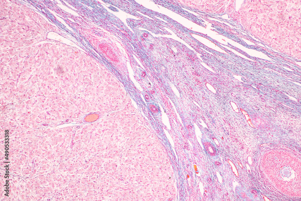 Anatomy and Histological Ovary, Testis and Sperm human cells under ...