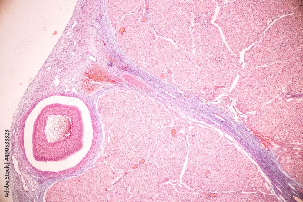 Anatomy and Histological Ovary, Testis and Sperm human cells under ...