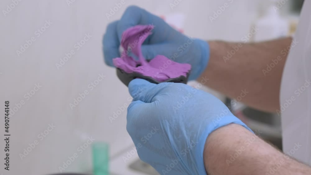 Doctor orthodontist in gloves holds a fingerprint for denture purple ...