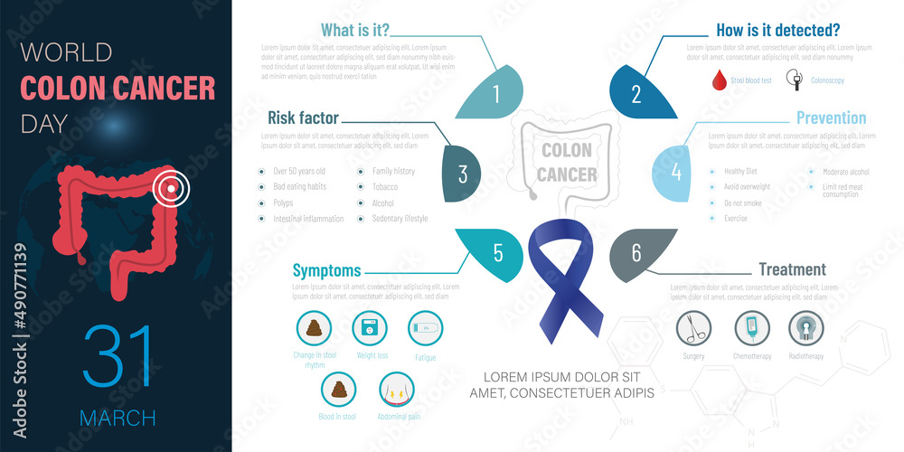 Colon Cancer Infographic.Infographic of colon cancer, including what it ...