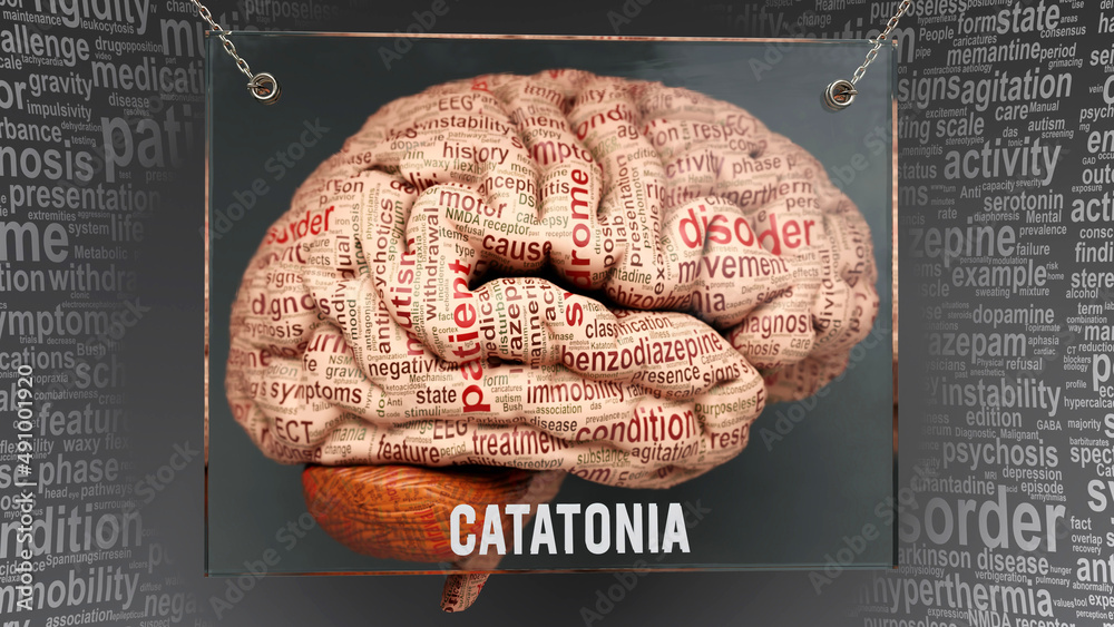 Catatonia anatomy - its causes and effects projected on a human brain ...