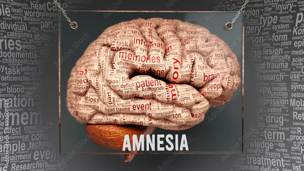 Amnesia anatomy - its causes and effects projected on a human brain ...
