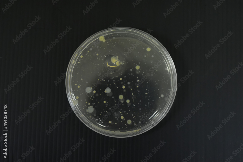Colonies of bacteria growth on agar plate medium Stock Photo | Adobe Stock