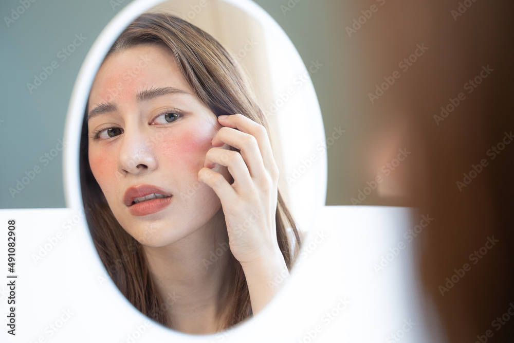 Foto de Asian young woman looking face skin in the mirror have a red ...