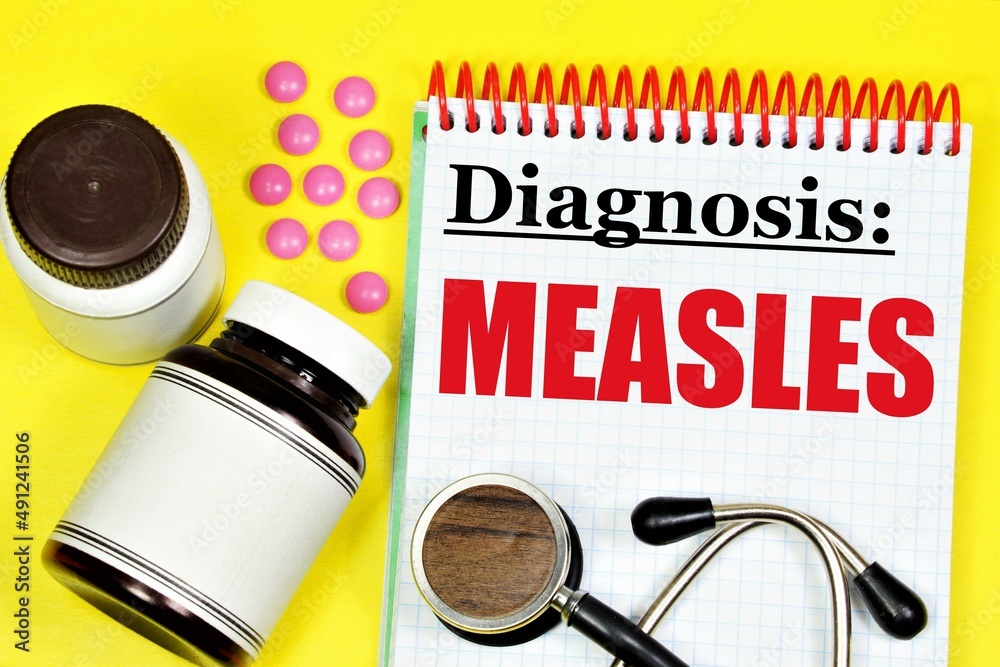 Measles is an infectious viral disease. The inscription of the ...