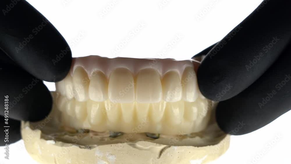 two dental prostheses of the upper and lower jaws made of zircon ...