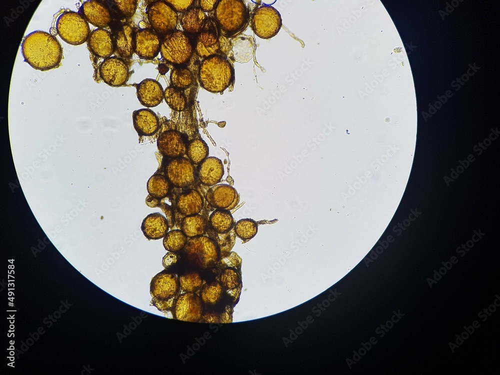 Arbuscular Mycorrhizal Fungi. Photomicrograph. Microscopic image of ...