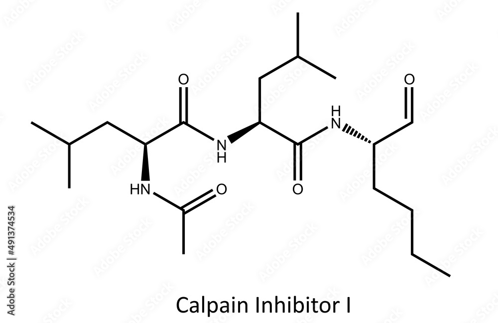 Calpain Inhibitor I inhibits tumor necrosis factor-induced (TNF-induced ...