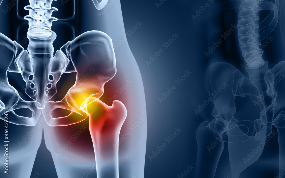 Bones Of The Pelvis And Hip Human Anatomy Femur Bone Joint Pain X Bones Of The Pelvis And Hip Human Anatomy Femur Bone Joint Pain X