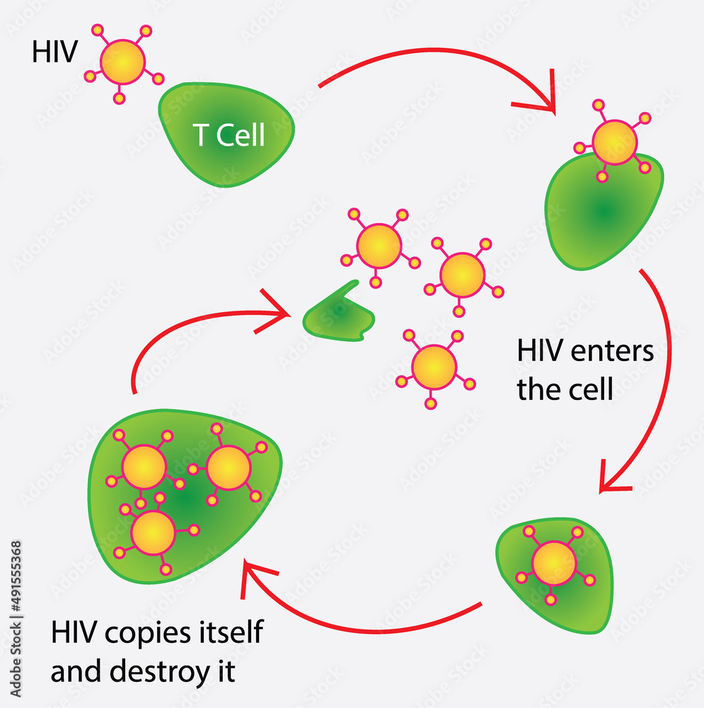 This diagram shows how HIV infects and destroys T cells ...