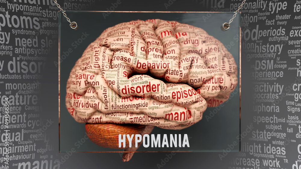 Hypomania anatomy - its causes and effects projected on a human brain ...