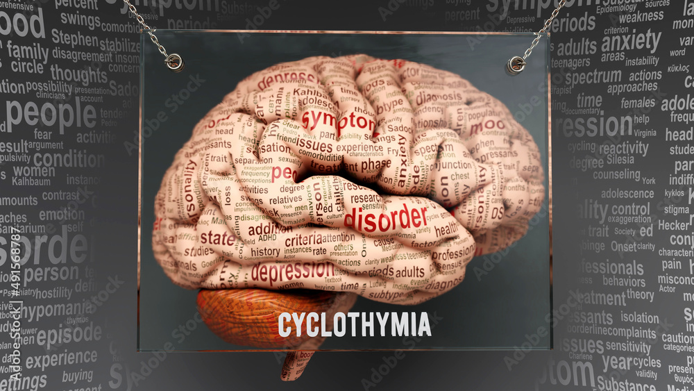 Cyclothymia anatomy - its causes and effects projected on a human brain ...
