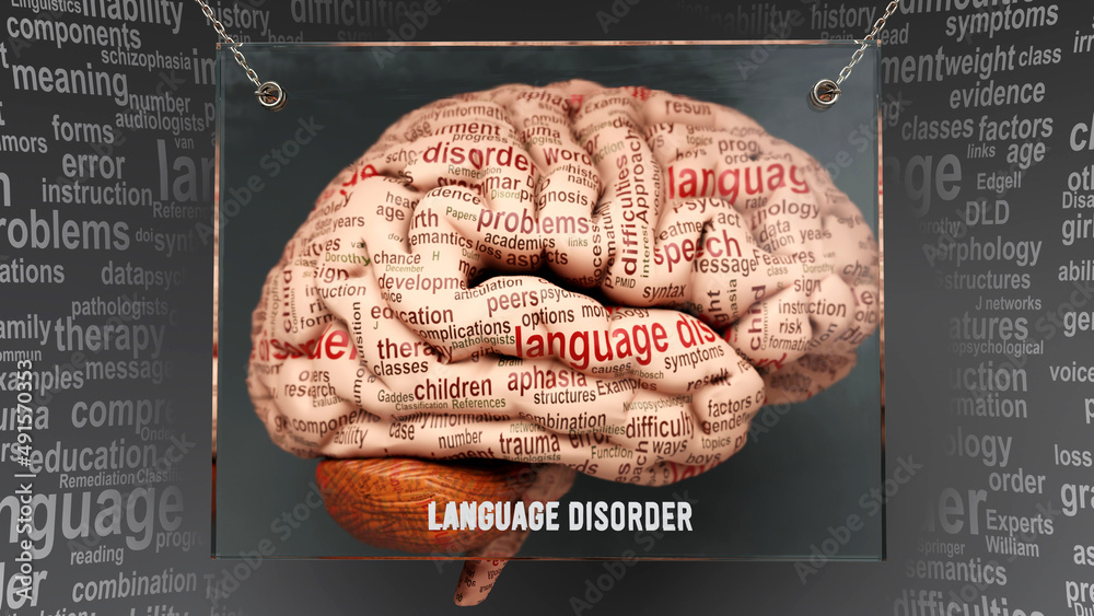 Language disorder anatomy - its causes and effects projected on a human ...