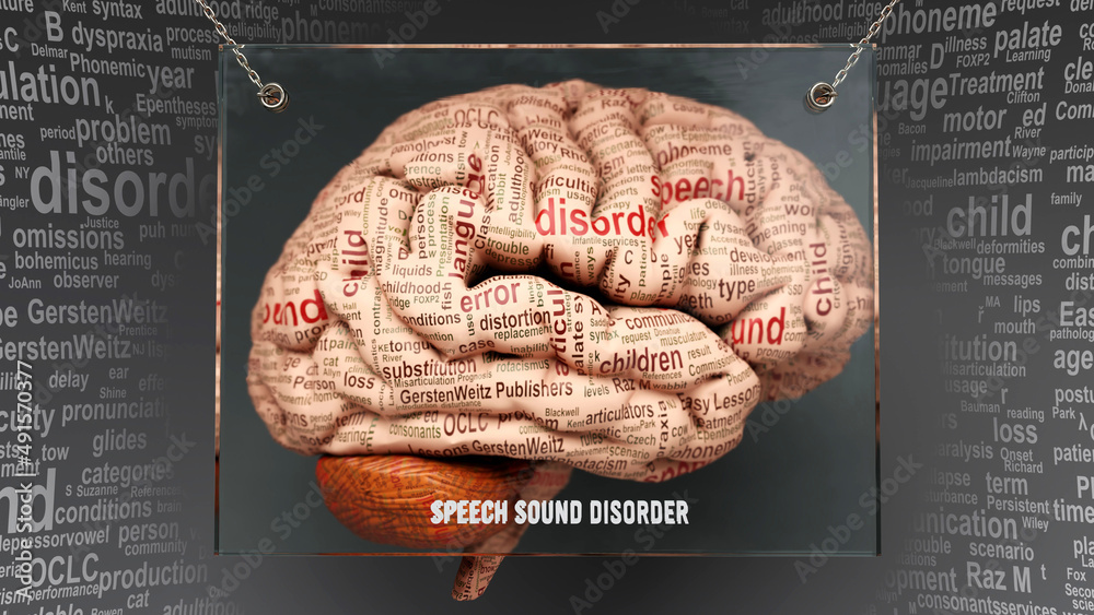 Speech sound disorder anatomy - its causes and effects projected on a ...