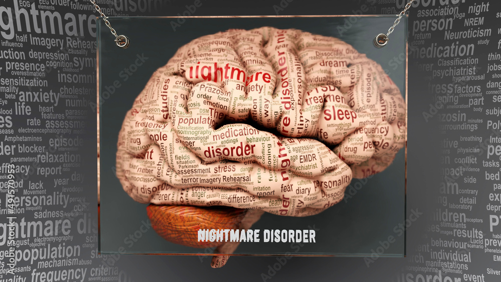 Nightmare disorder anatomy - its causes and effects projected on a ...