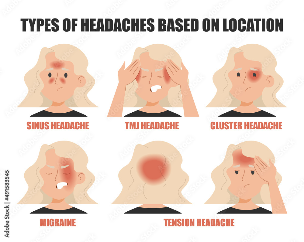 Types of headache based on location vector isolated. Pain in different ...