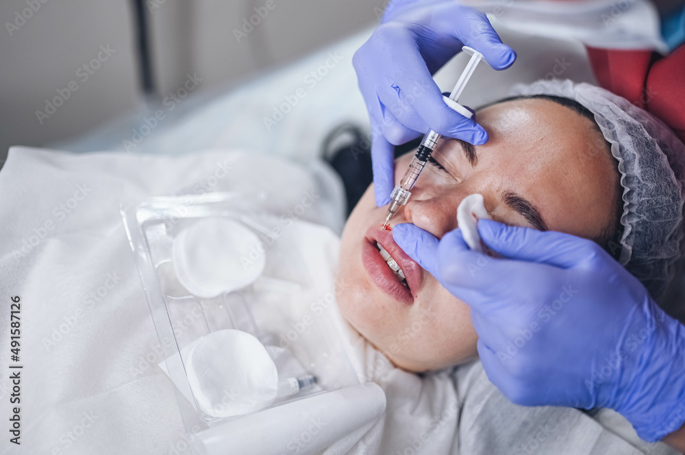 Cosmetologist doing painful lip augmentation procedure with hyaluronic ...