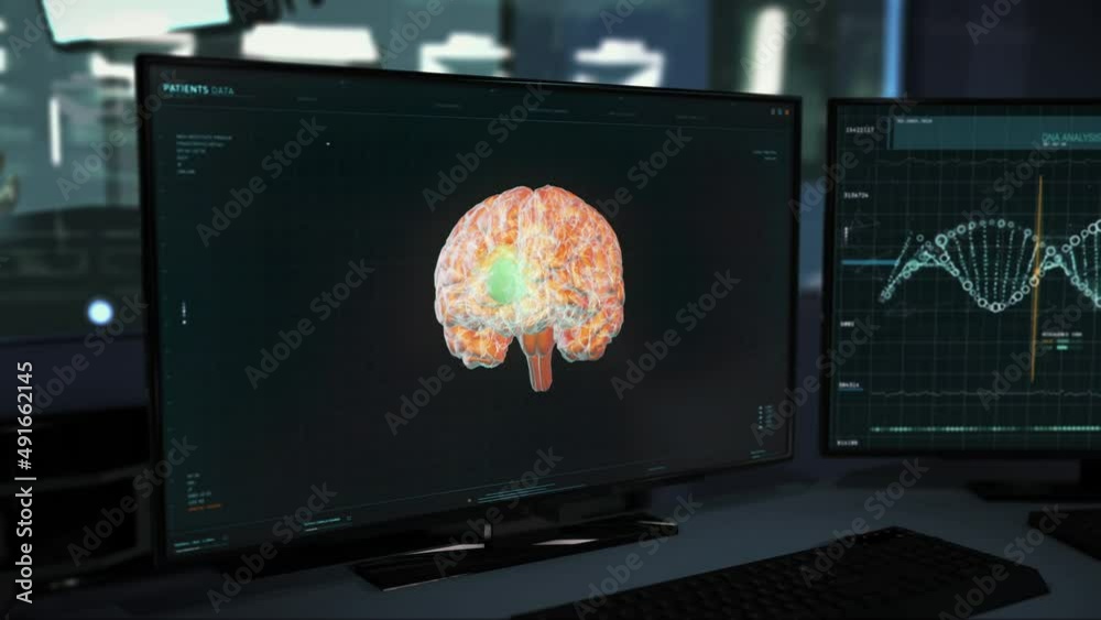 Innovative Medical Scanner Diagnoses Brain Tumor During X-Ray ...
