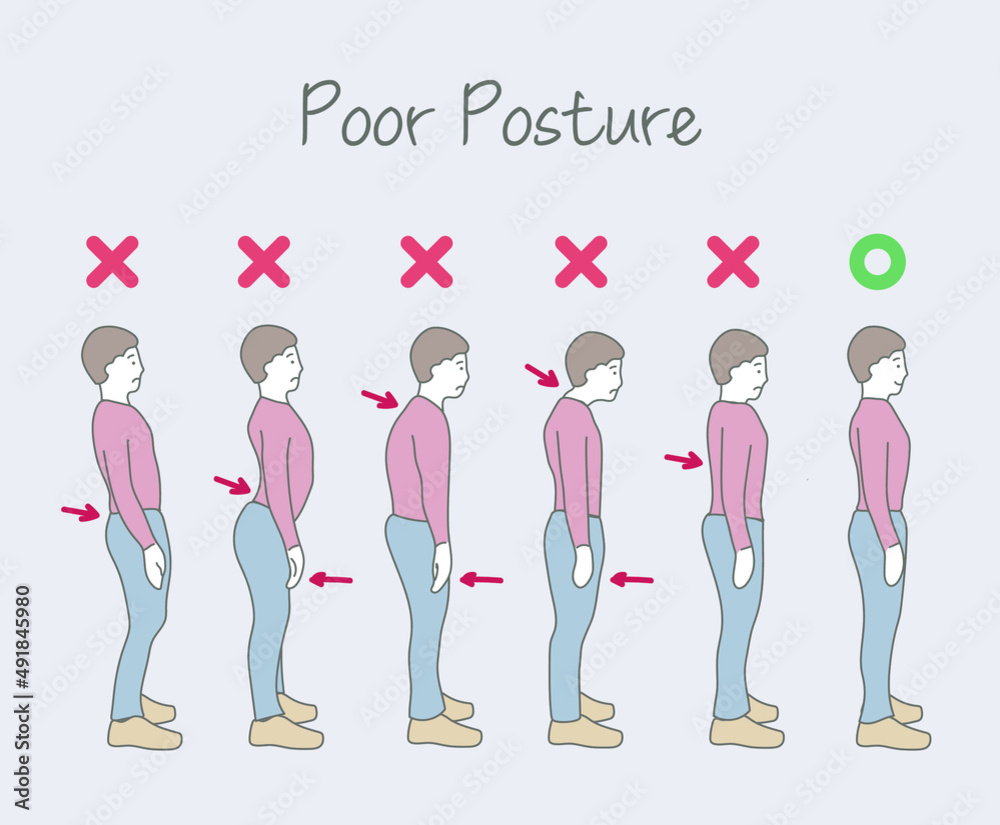 Poor and Good posture. Back and posture problems illustrations set ...