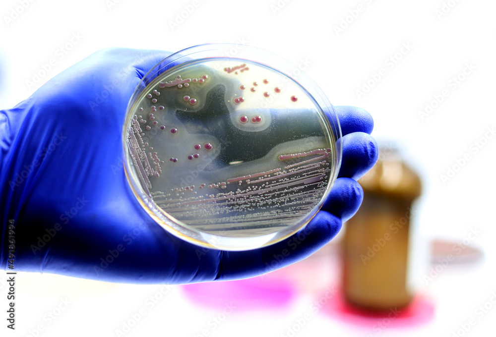 Bacterial colonies of the bacterium Methicillin-resistant ...