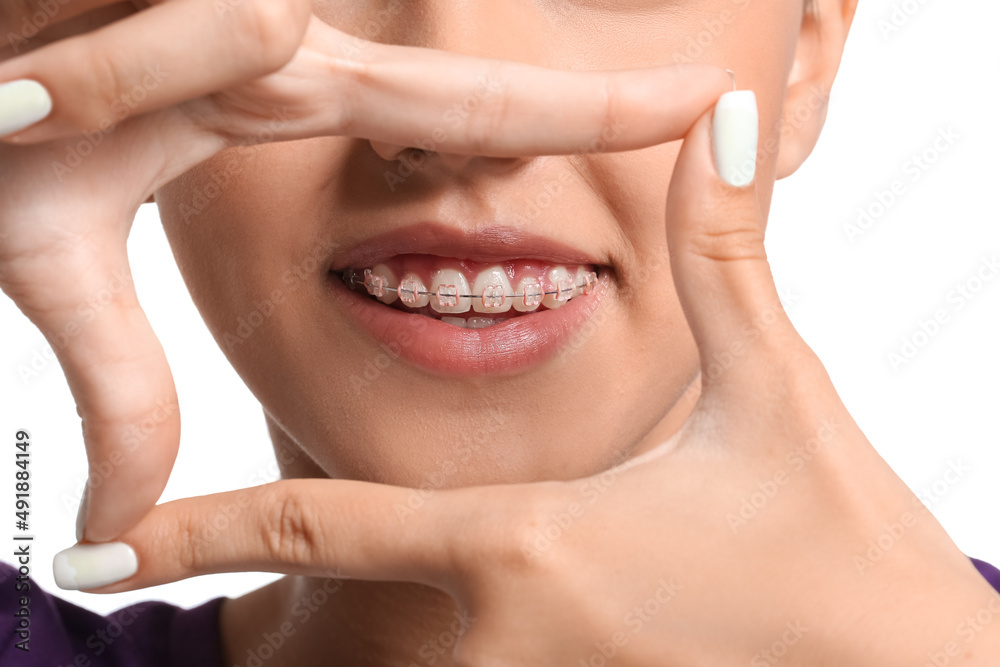 Pretty teenage girl with dental braces making frame gesture on white ...