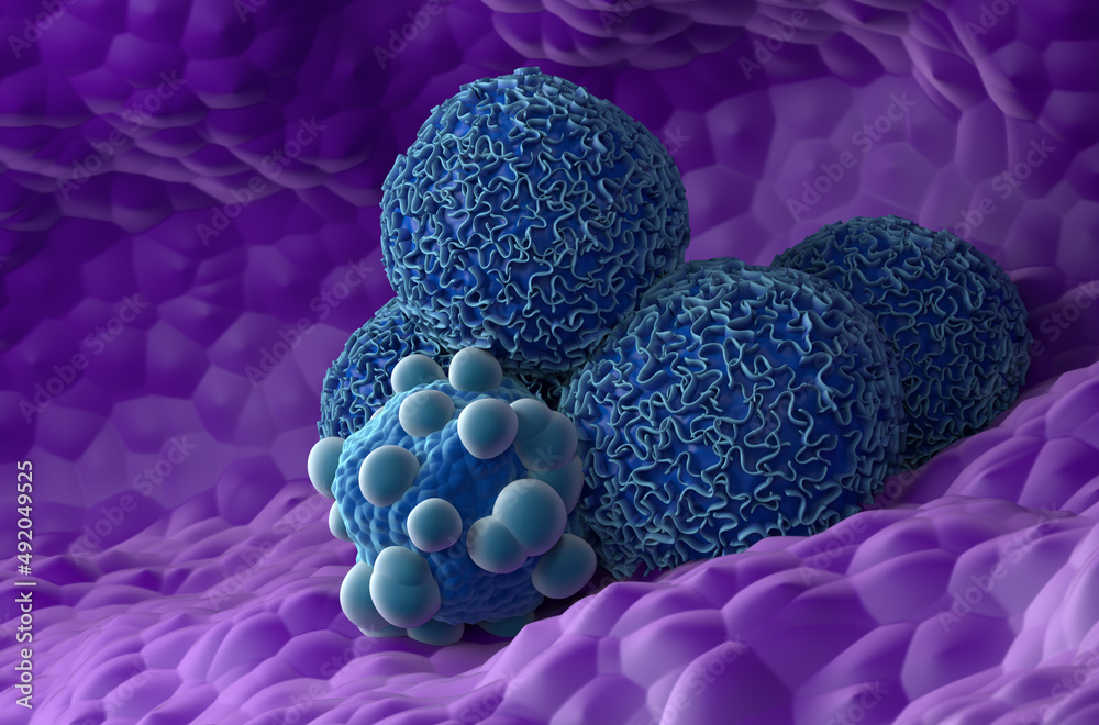 Pancreatic cancer cells - closeup view 3d illustration Stock ...