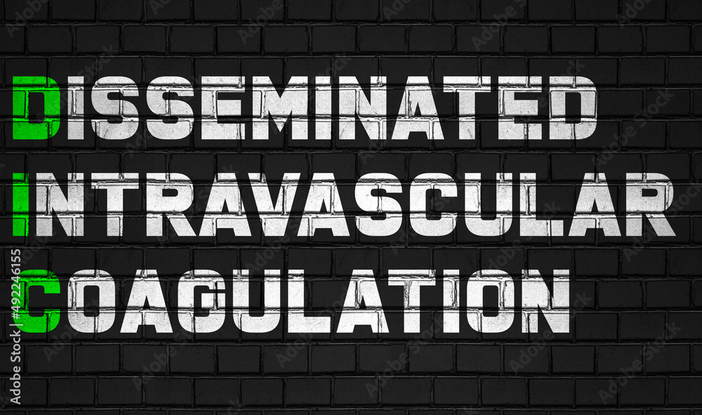 Disseminated intravascular coagulation(DIC) concept,healthcare ...