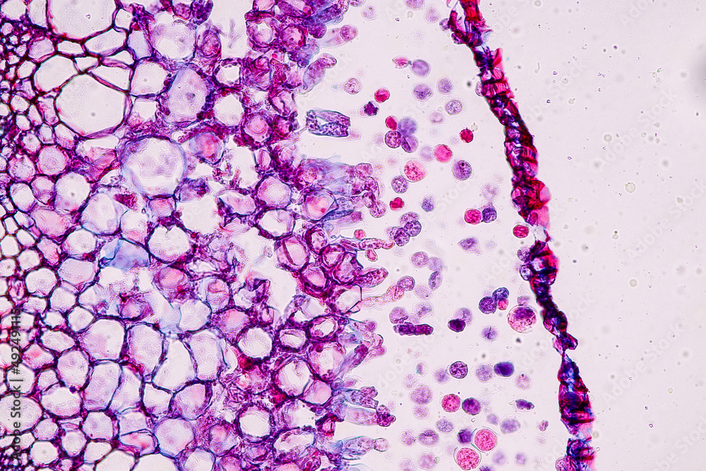 Host cells with spores (mold) are inside wood under the microscope for ...
