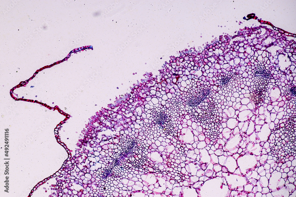 Host cells with spores (mold) are inside wood under the microscope for ...