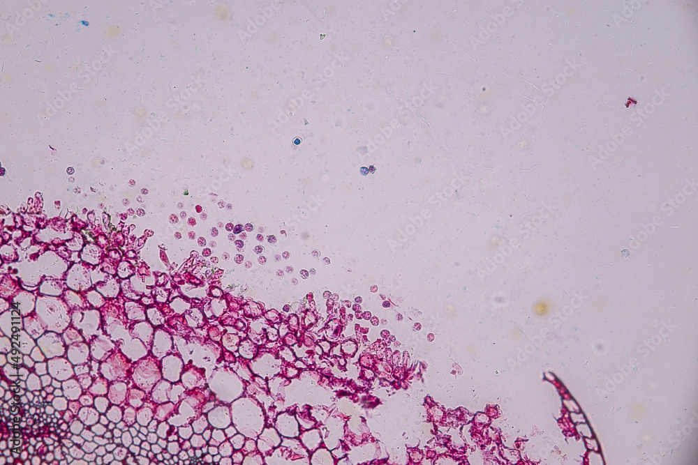 Host cells with spores (mold) are inside wood under the microscope for ...