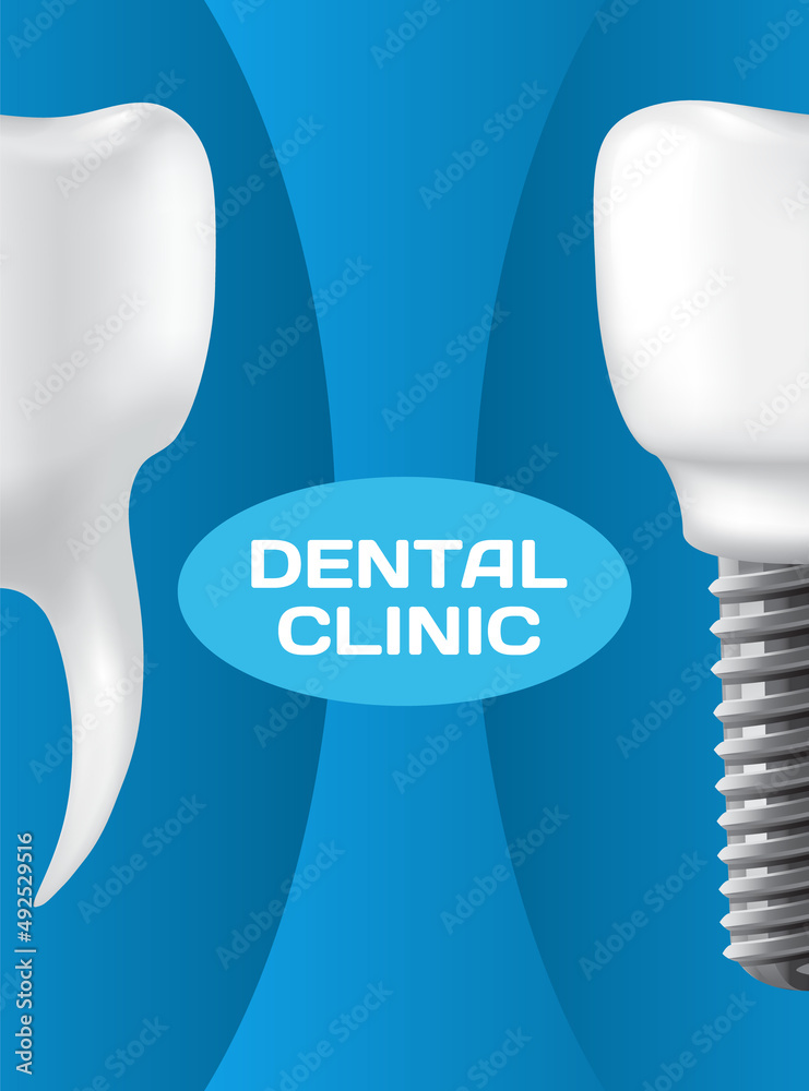 Dental clinic poster vector illustration. Advertising of hospital for ...
