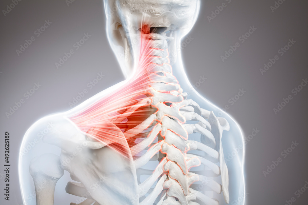 Neck pain, cervical vertebrae spine, human body anatomy Stock ...
