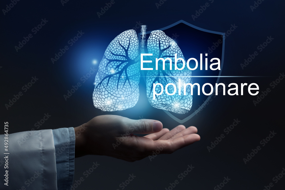 Medical banner Pulmonary Embolism with italian translation Embolia ...