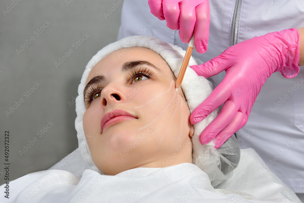 Thread lifting. Tightening of flabby skin in the jaw area with the help ...