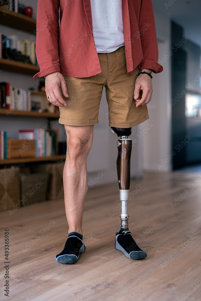Crop person with leg prosthesis Stock Photo | Adobe Stock
