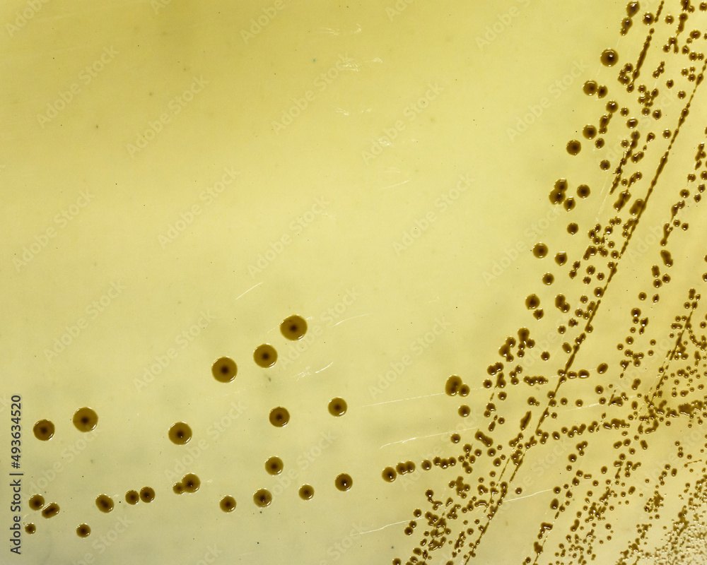 Bismuth Sulfite Agar