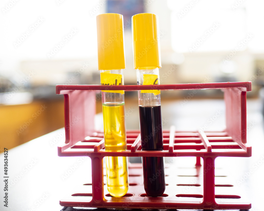 Food safety pathogen Listeria monocytogenes in Fraser broth, from a ...