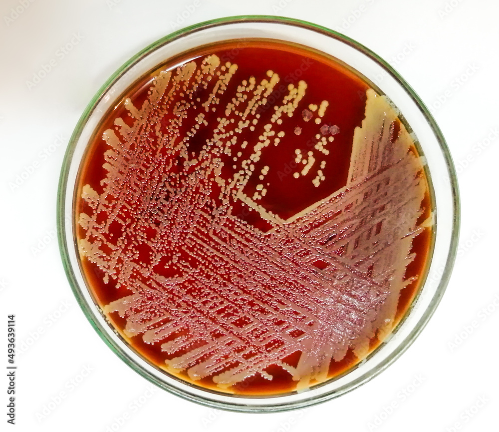 Staph aureus: Gram positive bacteria. Staphylococcus or streptococcus ...