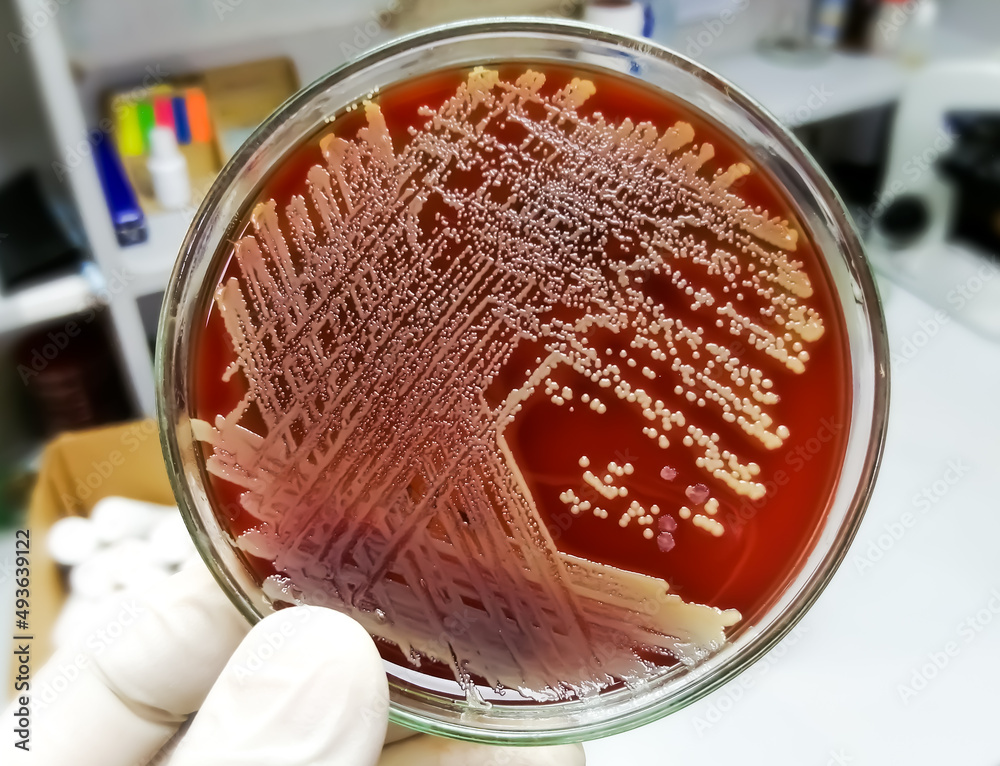Staph aureus: Gram positive bacteria. Staphylococcus or streptococcus ...